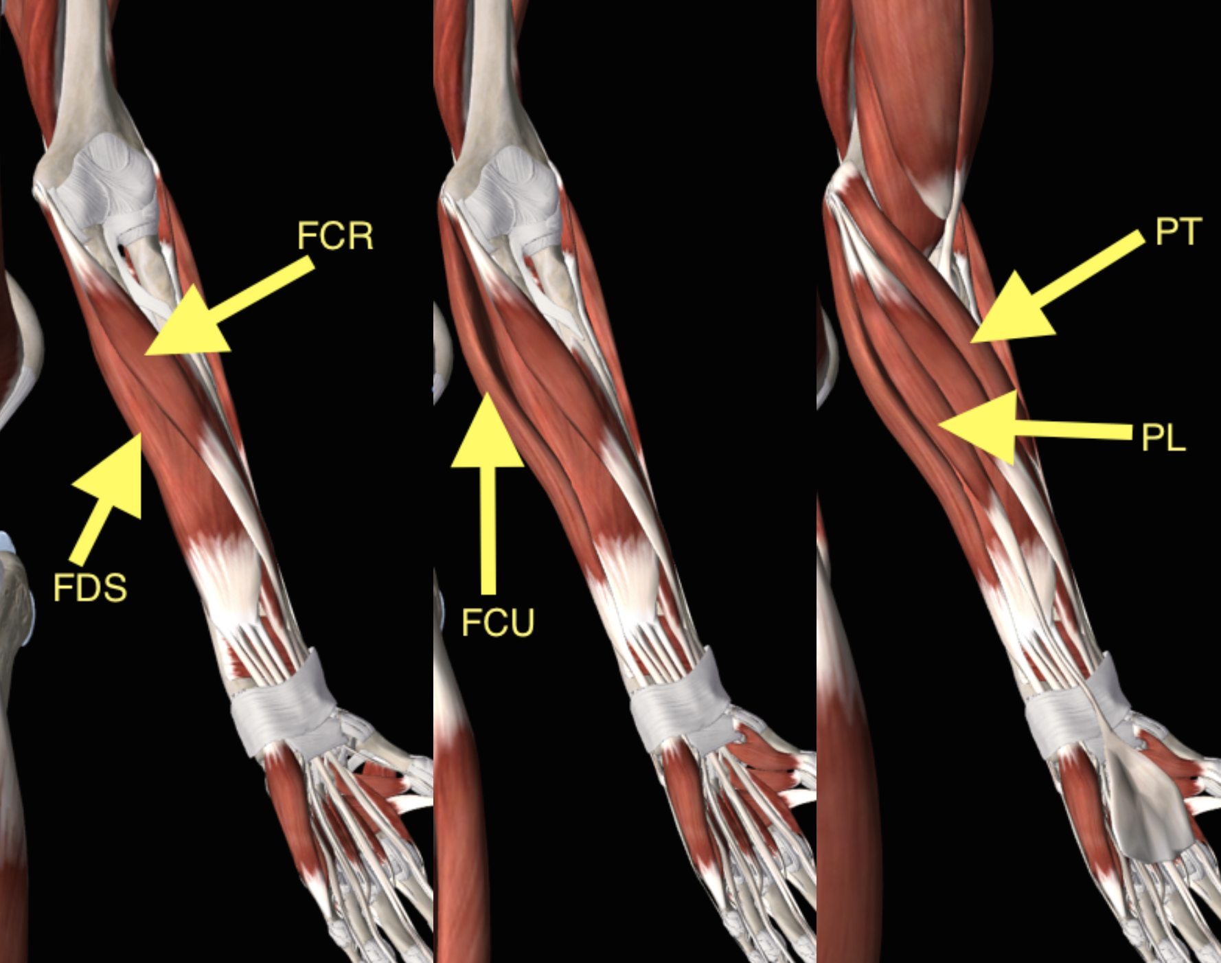 Eccentric Biceps Is The Devil For A Throwing Athlete | Florida Baseball ...